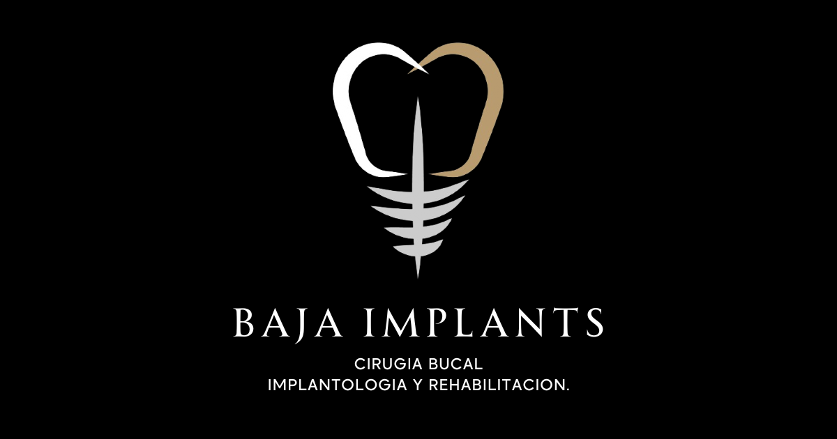 Baja Implants Tijuana - Implantes dentales, Cirugia Bucal y Más - Baja ...